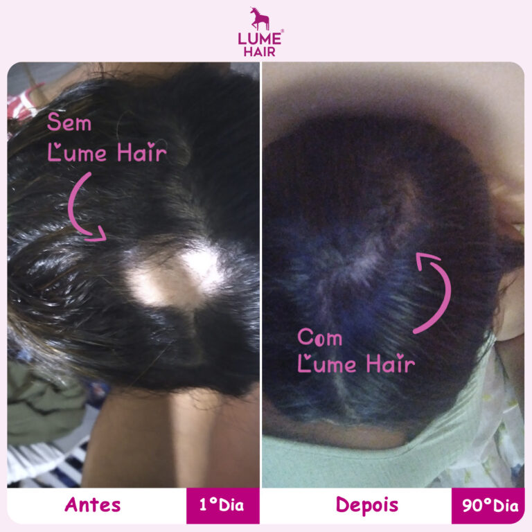 Lume Hair Vitamina Oficial - Lume Hair